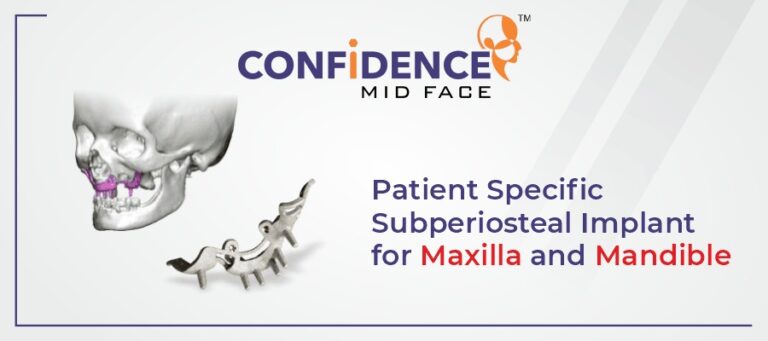 Confidence: Patient-specific Implants for Subperiosteal, Maxilla and ...