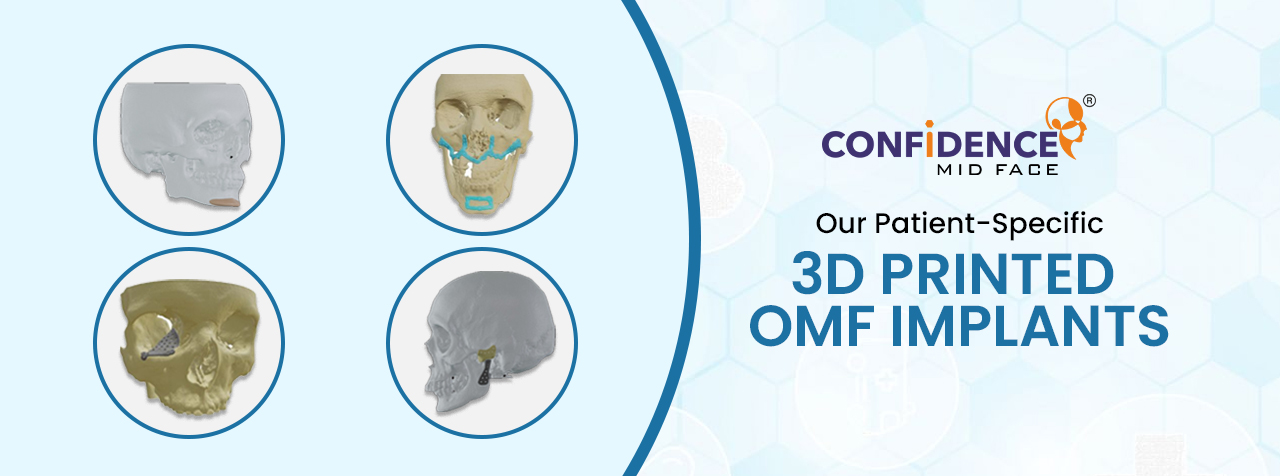 Maxillofacial Implants | Maxillofacial Surgery | 3D Incredible, India