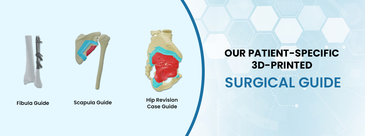 Surgical Guides | 3DIncredible